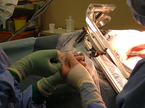 Biopsy | Urdu Meaning of Biopsy